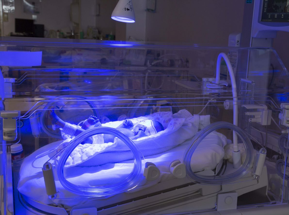 Brain haemorrhage (bleeding) | Bliss