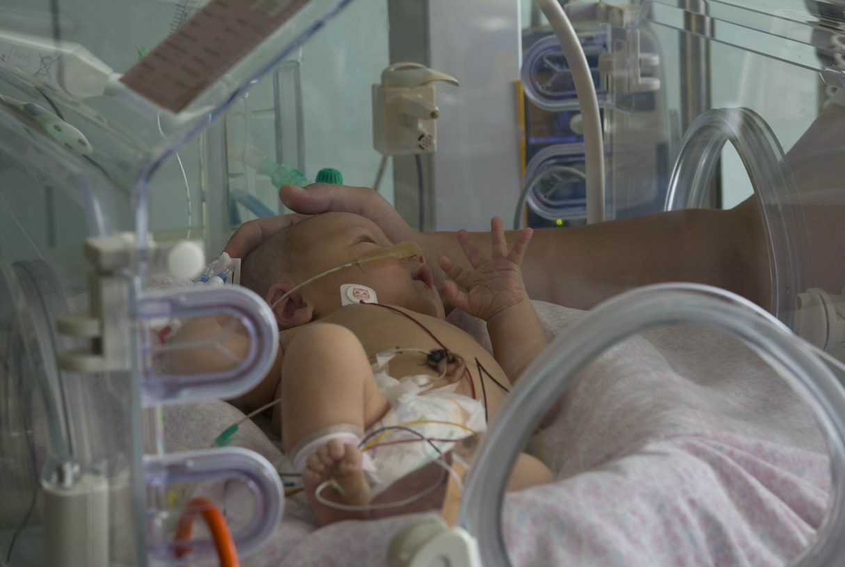 Brain haemorrhage (bleeding) in full term babies | Bliss