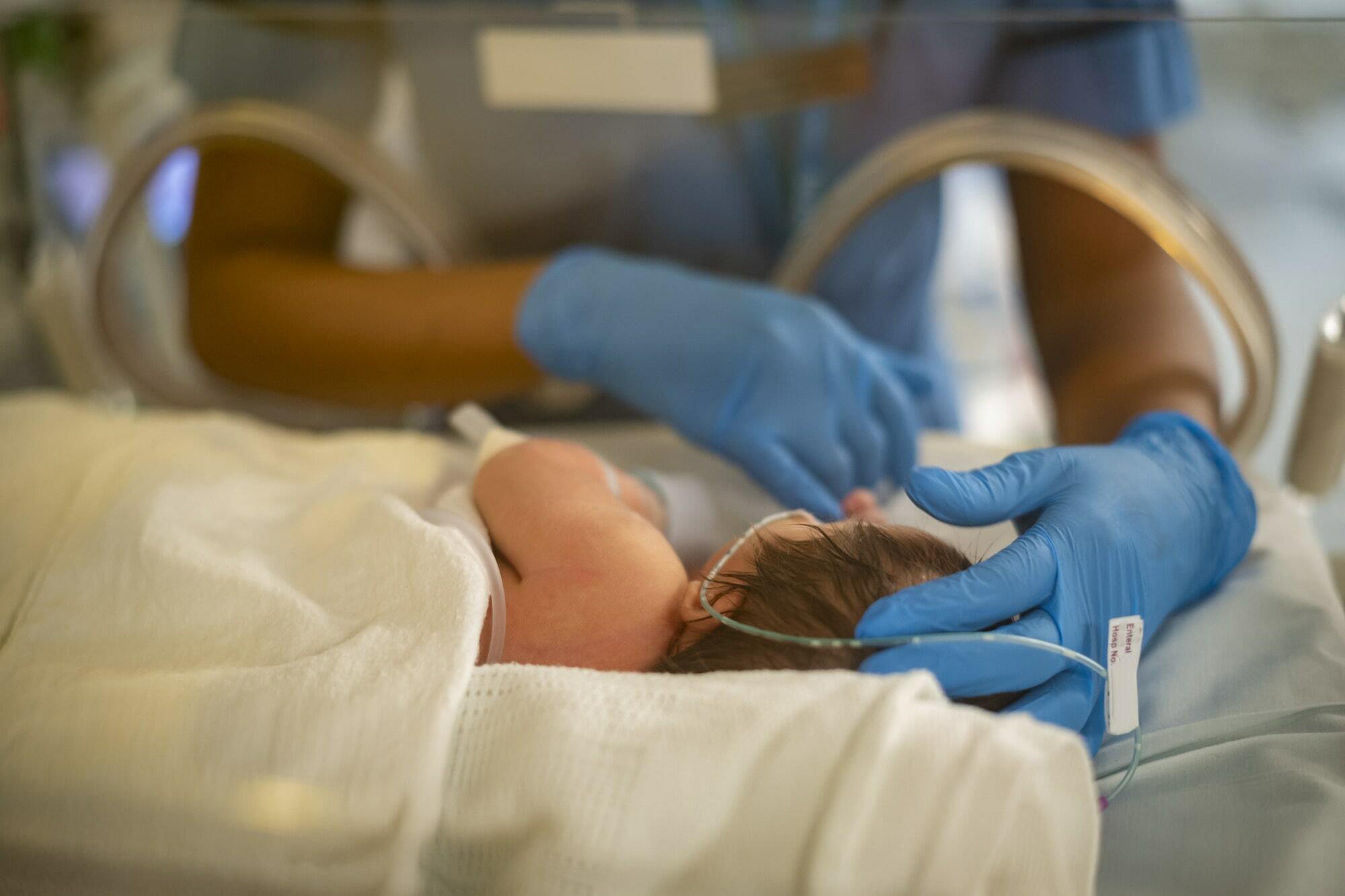 Neonatal herpes (Neonatal HSV) | Bliss