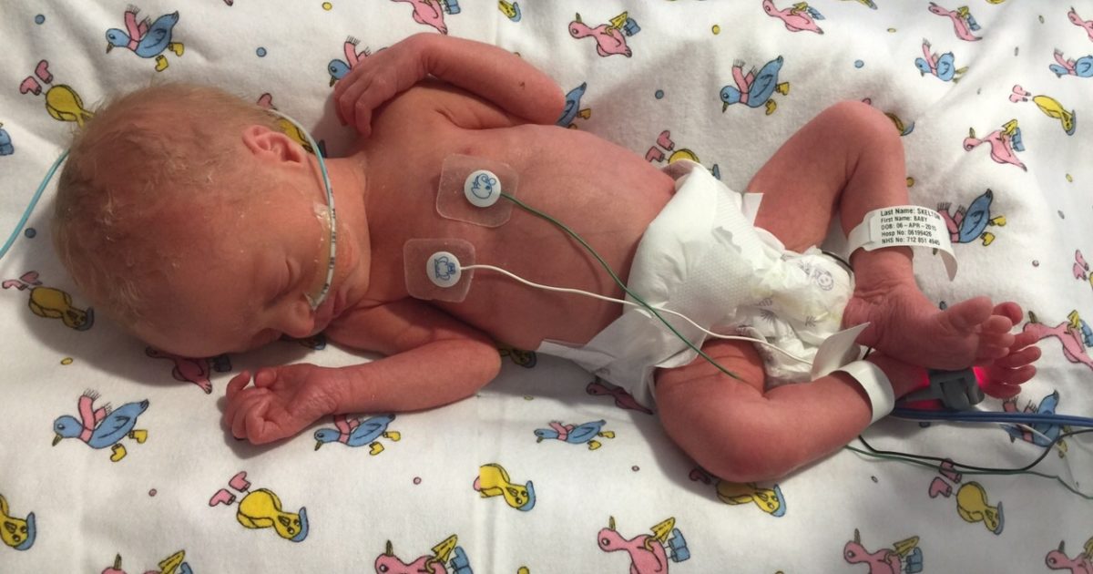 My 33 weeker - Natasha's story | Bliss