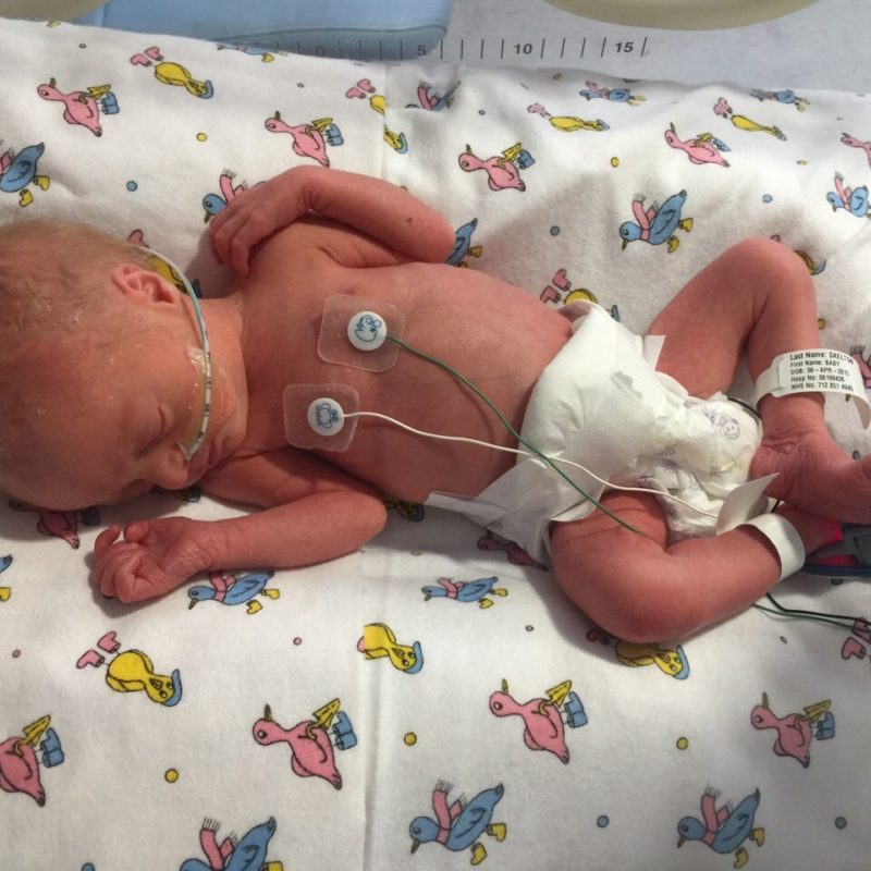 33 weeks pregnant problems