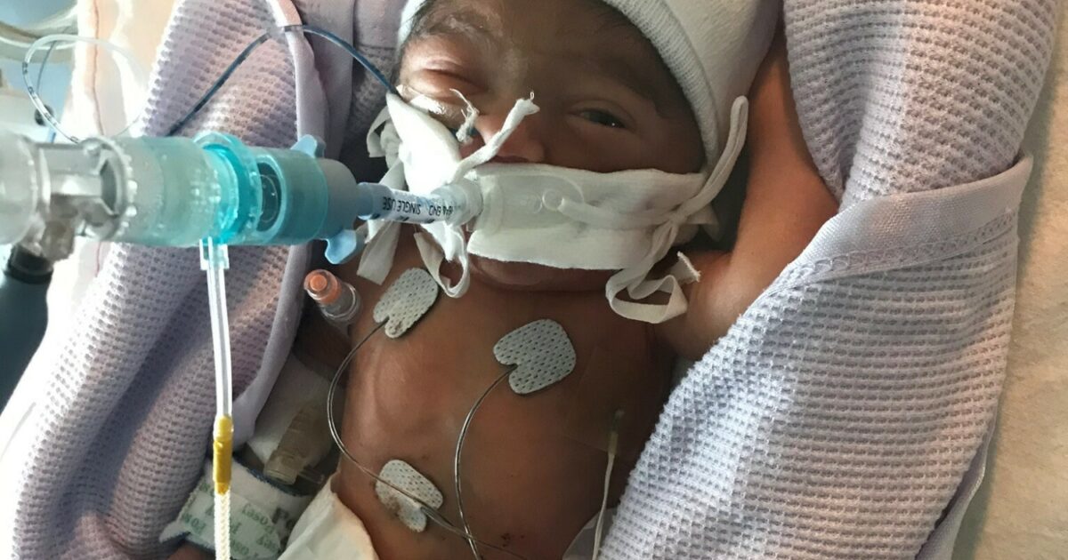 “I was diagnosed with PTSD months after our baby came home from NICU ...